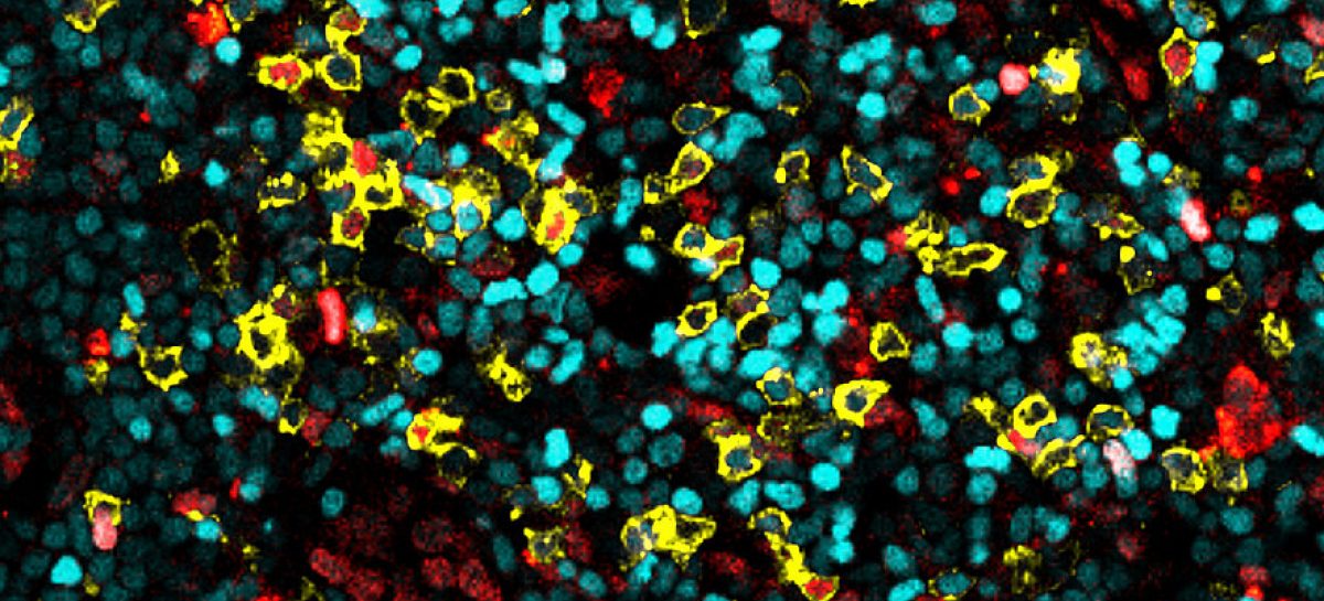 Celule T, gardienii imunitari, descoperite în ganglionii limfatici ...