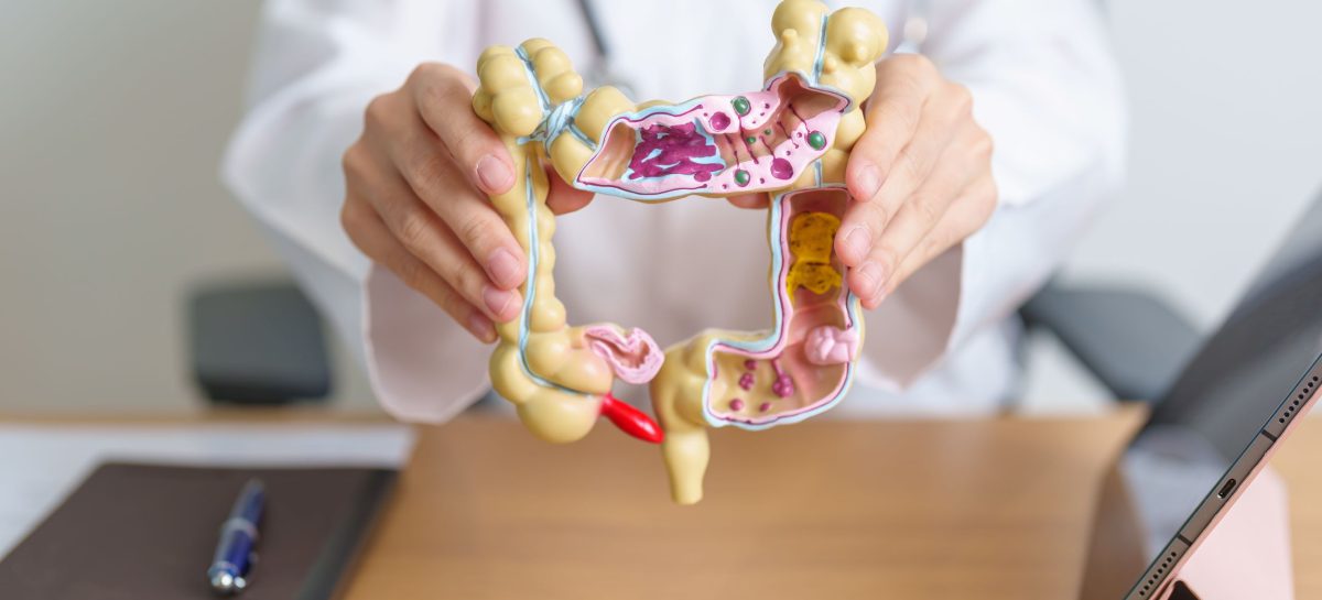 Un medicament pentru boli inflamatorii intestinale a obținut rezultate ...